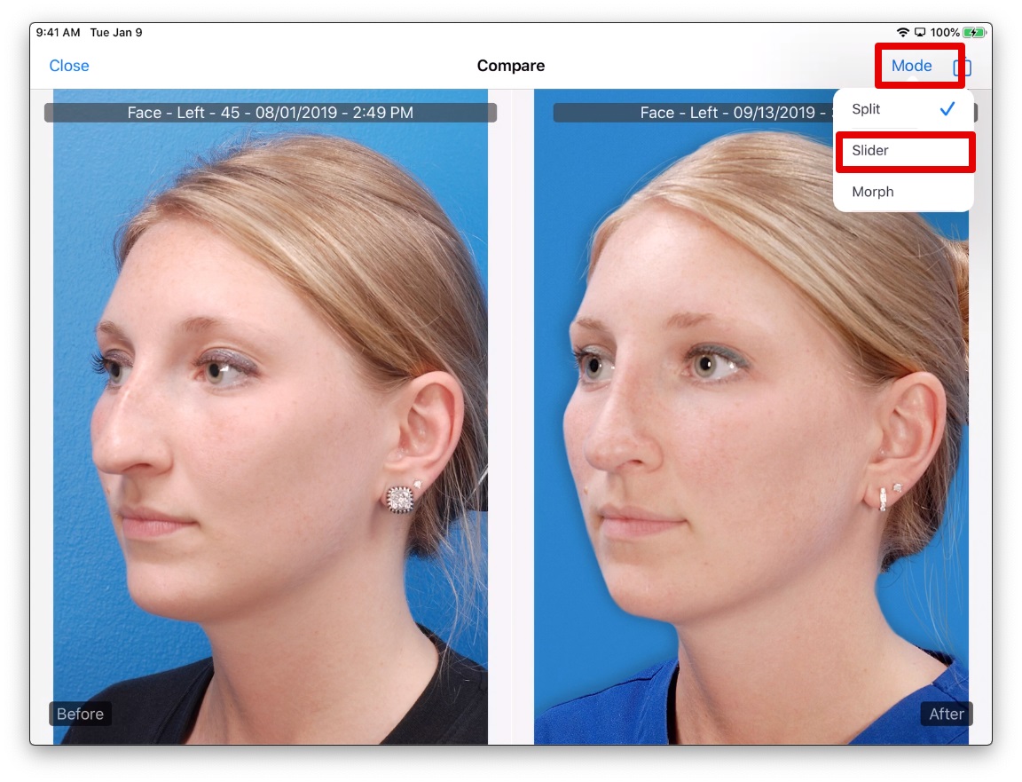 RxPhoto - Compare Photos - Side-by-Side, Slider, and Morphing Tools