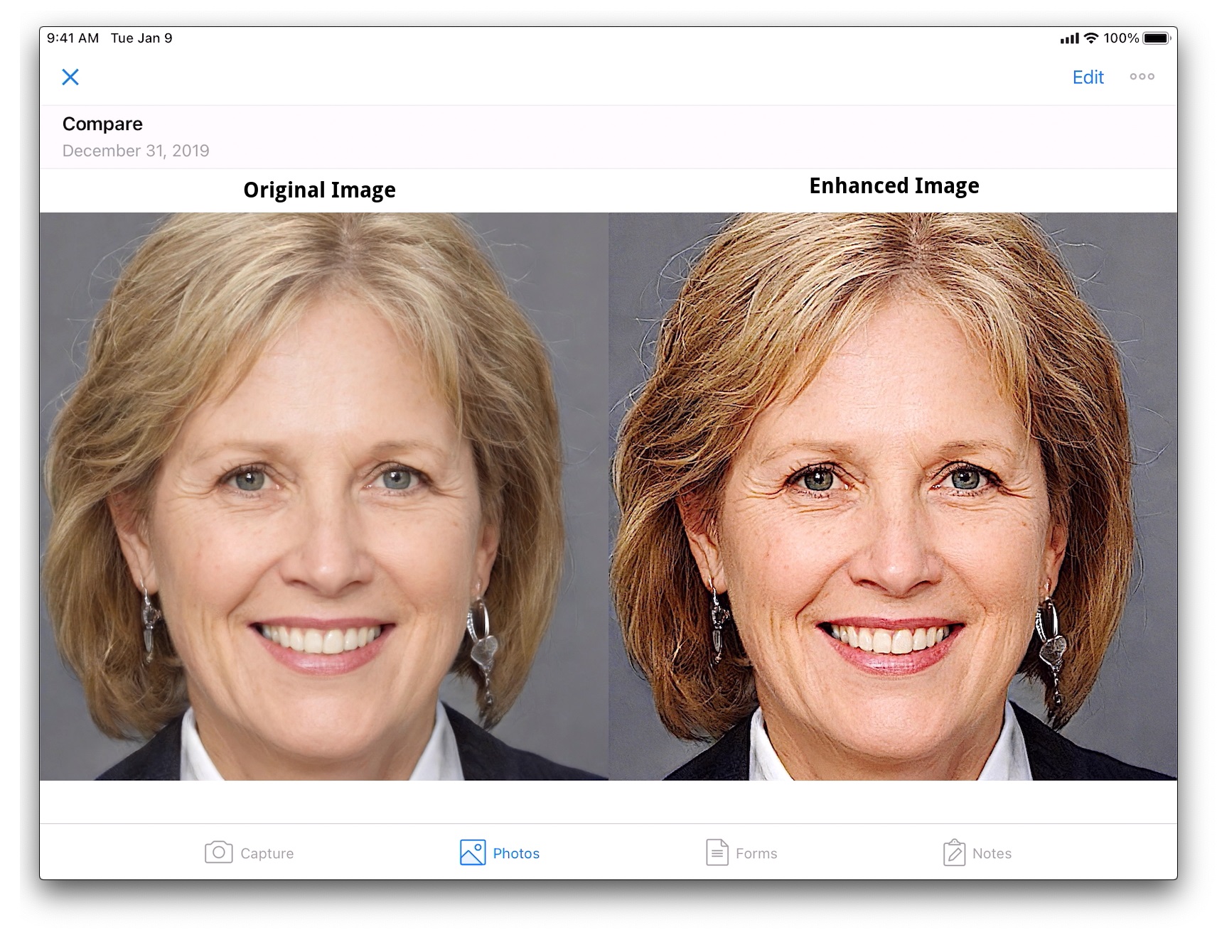 RxPhoto - Updated Image Editing