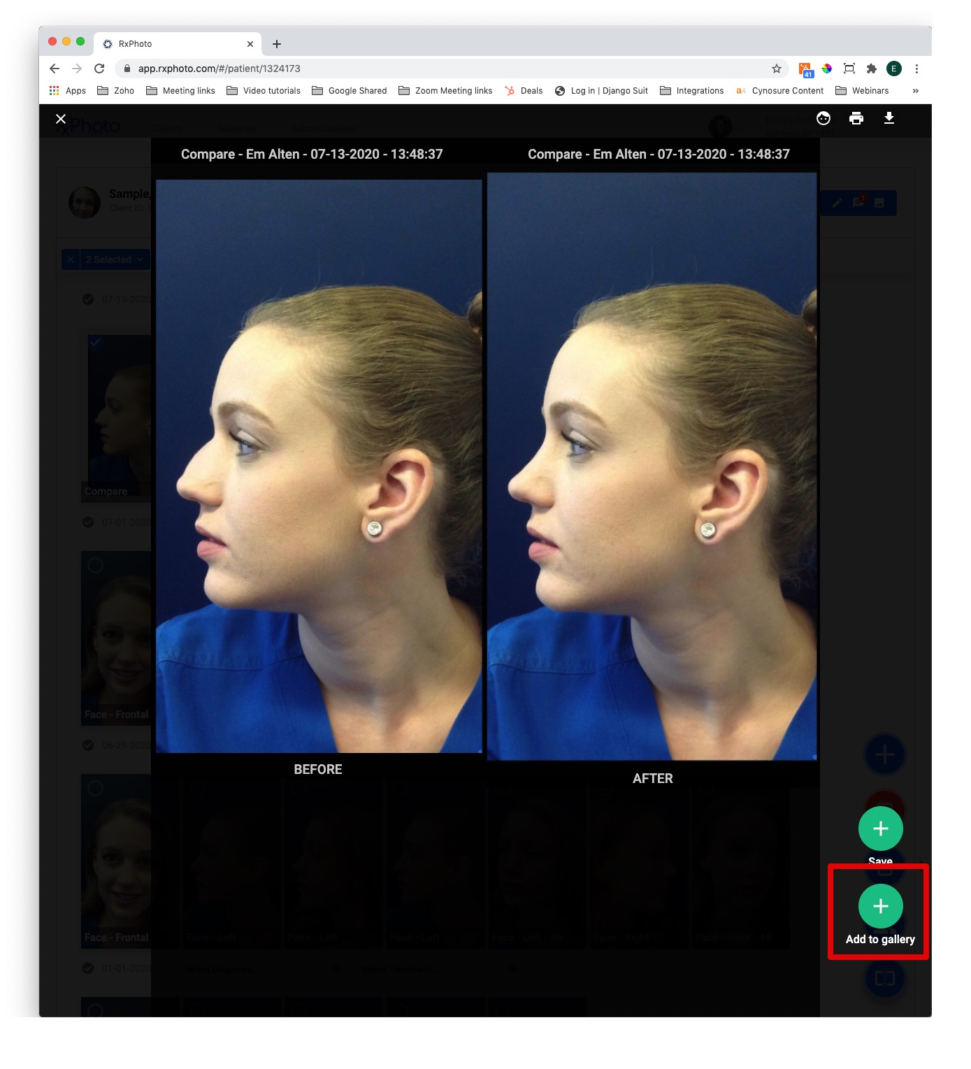 RxPhoto - Add Before & After Photos to a Gallery-Website